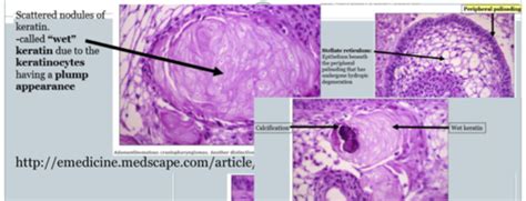 Pathology Of Pituitary Hypothalamus And Pineal Gland Flashcards Quizlet