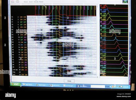 In This Sept Photo DNA Fragments Are Composed To Match Evidence Samples And Solve