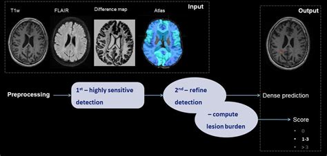 Prior Knowledge Informed Deep Learning For Lacune Detection And Quantification Using Multi Site