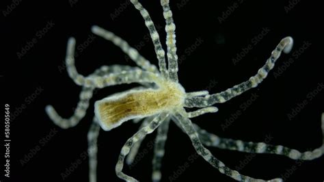 Video „adult Larva Of Sea Anemone Actiniaria Under Microscope Class Anthozoa Phylum Cnidaria