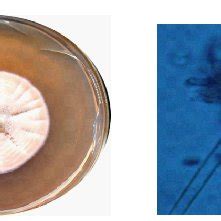 Morphological And Sporulating Structure Of The Isolated Fungus Download Scientific Diagram