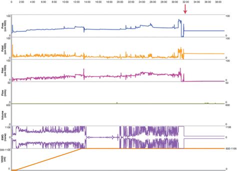 Bladder Emptying Contractility Abdominal Key
