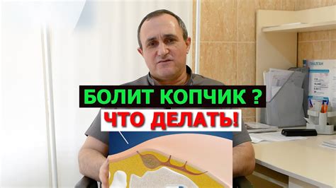 Киста копчика виды причины симптомы и лечение