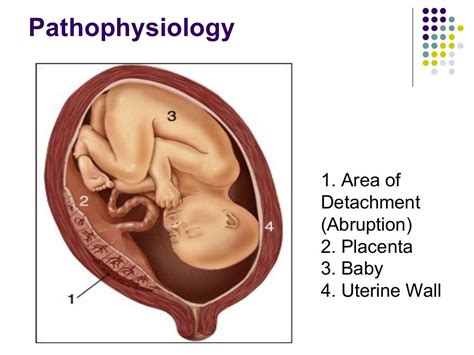 Abruptio Placenta
