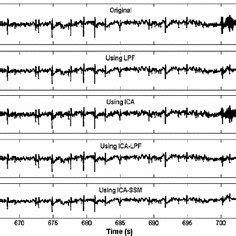 Signal C4 From Data In Fig 3 A Before And After B LPF C ICA D Download Scientific Diagram