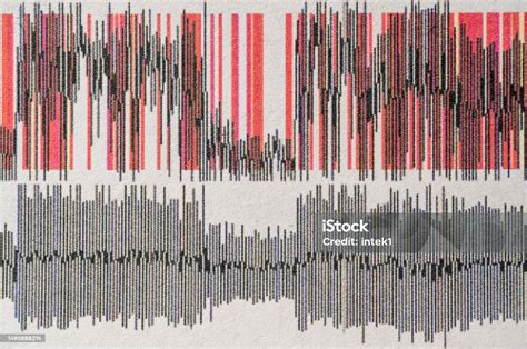 Images Charts Scientific Cardiograms Of Cardiorespiratory Sleep Monitoring Heart Pulse Or Heart