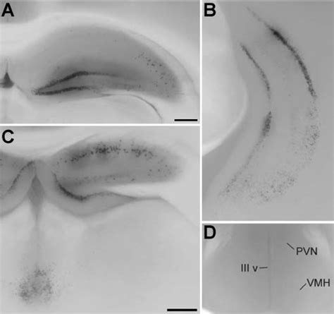Cre Mediated Recombination In Sm22 ␣ Cre ϩ Nt 3 ϩ Lox Lacz Mice