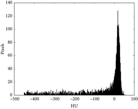 Histogram Of A Malignant Nodule With A Leptokurtic Ie Resembling A