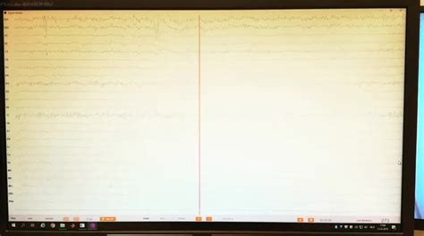 Anne Bach Cognitive Neuroscience Maastricht