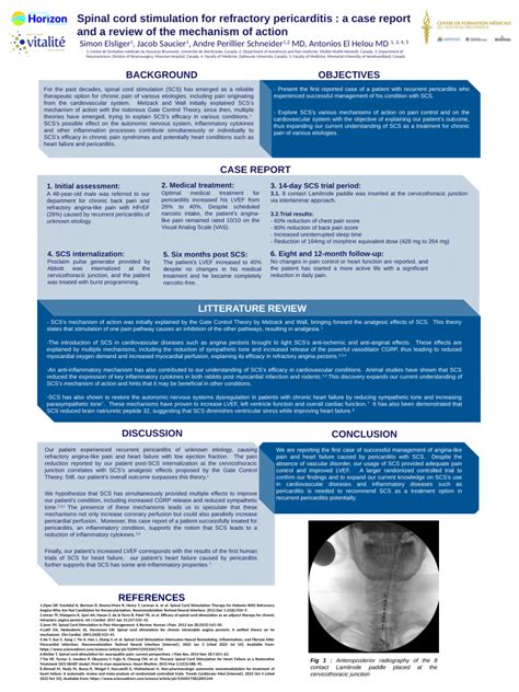 Pdf Spinal Cord Stimulation For Refractory Pericarditis A Case Report And A Review Of The