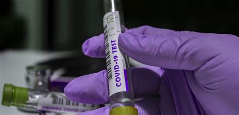 Normandie Covid 19 Le Taux De Reproduction Du Virus Au Dessus Du