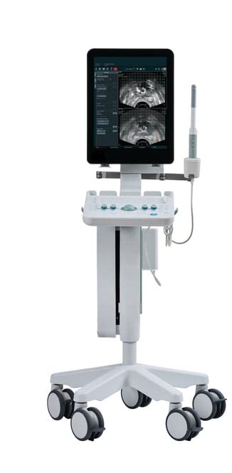 Bkfusion For Transperineal Prostate Biopsies With Local Anesthesia