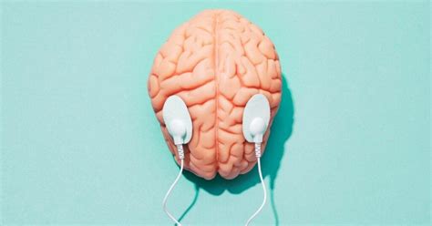 Electroconvulsive Therapy Ect