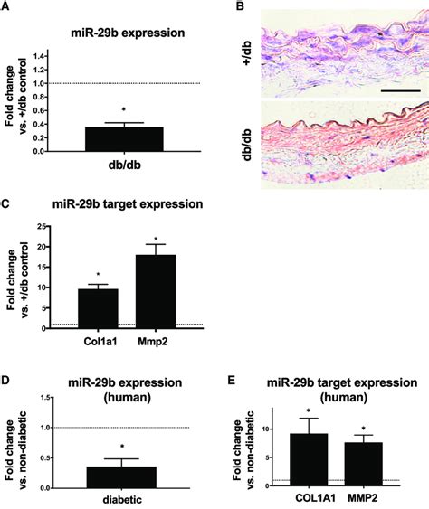 Diabetic Aortae Show Reduced Levels Of Mir 29b And Elevated Mir29b