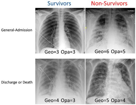 Diagnostics Free Full Text Longitudinal Chest X Ray Scores And Their Relations With Clinical