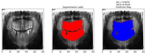 GitHub Data Driven User Analysis Laboratory Semantic Segmentatioin For Teeth X Ray Image