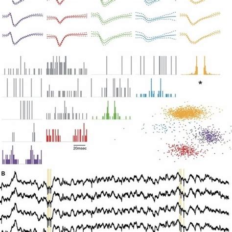 PDF Accurate Spike Sorting For Multi Unit Recordings