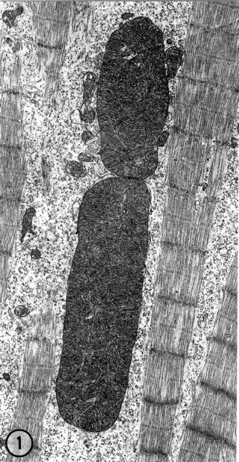 Two Interfibrillar Megamitochondria Note Adjacent Mitochondria Of