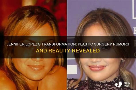 Jennifer Lopezs Transformation Plastic Surgery Rumors And Reality