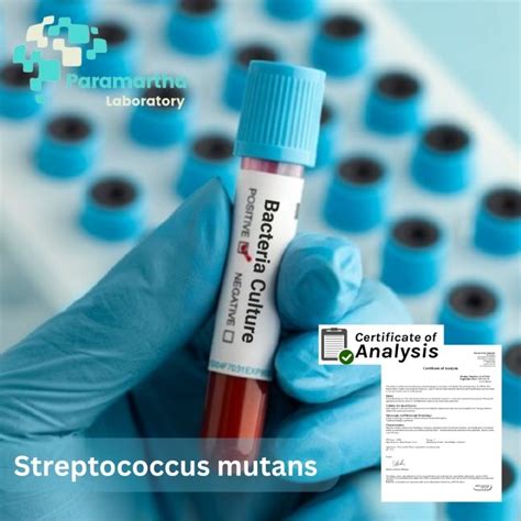 Jual Kultur Isolat Murni Bakteri Streptococcus Mutans Atcc Shopee