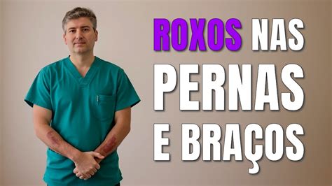 Manchas Roxas Na Pele Entendendo As Causas E Opções De Tratamento