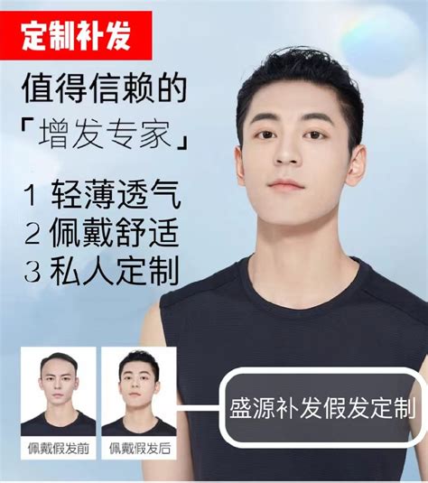 长春盛源织发补发假发定制中心 长春补发织发假发定制服务专业店