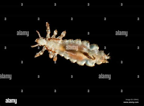 Head Louse Pediculus Capitis Pediculus Humanus Capitis Pediculus