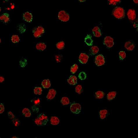 Cd15fut4 Reed Sternberg Cell Marker Monoclonal Antibody Fr4a5