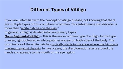 Ppt Vitiligo Types Powerpoint Presentation Free Download Id12598989