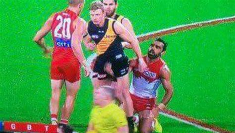 This Rugby Player Got His Penis Ripped During A Game Ouch Gallery