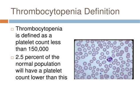 Ppt Thrombocytopenia Powerpoint Presentation Free Download Id988480