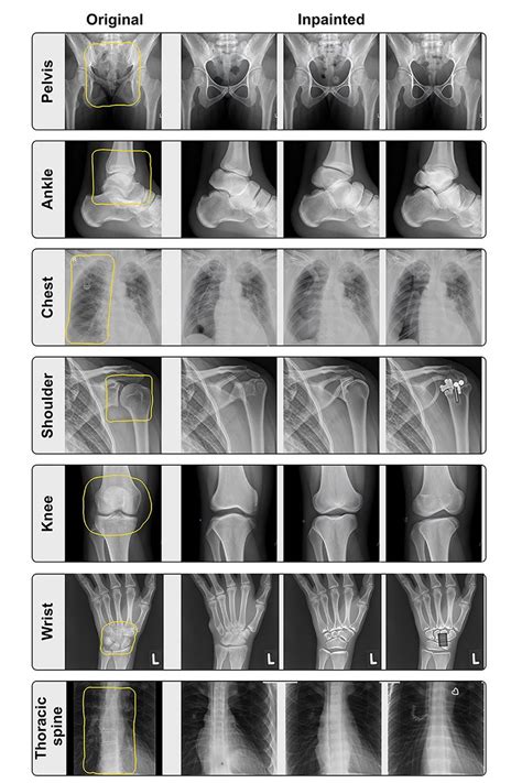 Can Ai Image Generator Dall E 2 Advance Radiology • Healthcare In