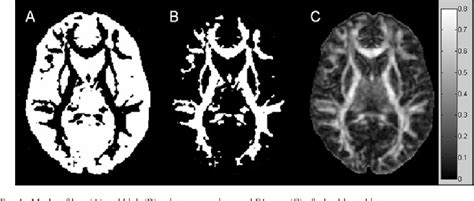 Figure 1 From Dependence Of Brain Dti Maps Of Fractional Anisotropy And