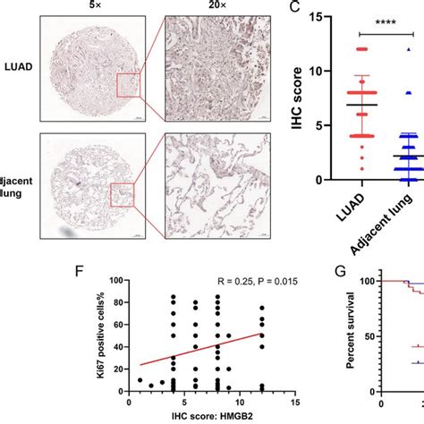 Identification Of Modules And Genes Associated With Luad Traits A