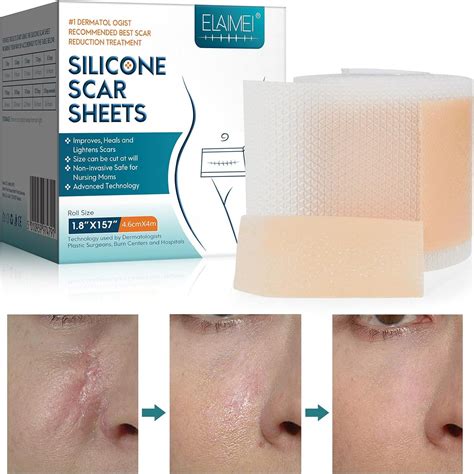 Scar Away Silicone Scar Sheets 18 X157 4m Medical Grade Tape For