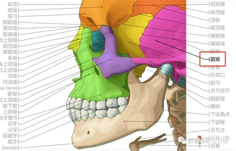 影像解剖 一问弄清翼窝、颞窝、颞下窝、翼腭窝ct解剖 脑医汇