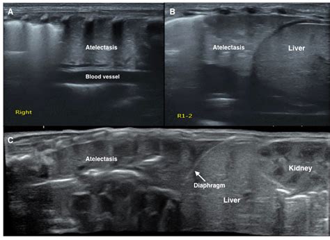 Protocol And Guidelines For Point Of Care Lung Ultrasound In Diagnosing