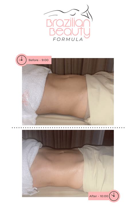 Brazilian Lymphatic Drainage Massage Nutritious Vitality