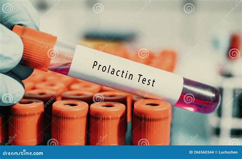 Examen De La Prolactine De La Glande Pituitaire Initie Et Maintient La Production De Lait Dans