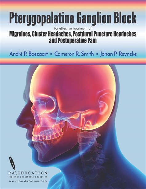 Buy Pterygopalatine Ganglion Block For Effective Of Migraine Cluster