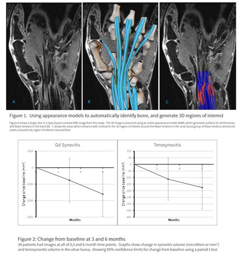 Quantitative Mri Measurement Of Tenosynovitis Demonstrates Differing Responses Of Synovitis And