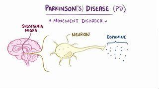 Bradykinesia What Is It Causes Diagnosis Osmosis