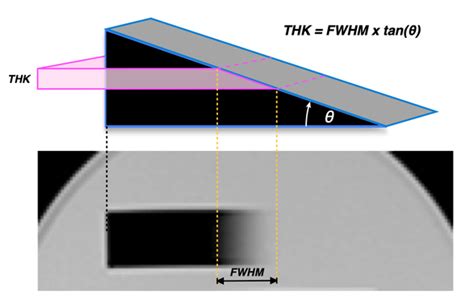 Slice Position And Accuracy Questions And Answers In Mri