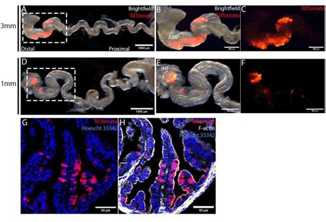 Somatic Genome Engineered Mouse Models Using In Vivo Microinjection And