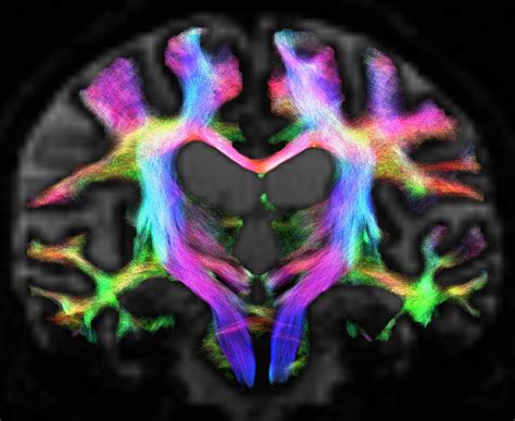 Beginner Connectome Pipeline Updated Mrtrix3 Community