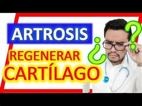 ARTROSIS DE RODILLA Cómo REGENERAR el CARTILAGO se puede