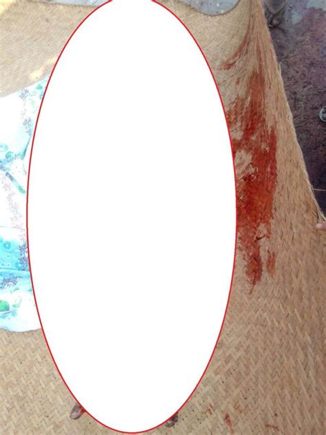 ခင်ဦးတွင် မပေါက်ကွဲသော လက်နက်ကြီးကျည်ကို ကောက်ယူရာမှ ပေါက်ကွဲမှုဖြစ်ပြီး ကလေးငယ် ၁ ဦး သေဆုံး