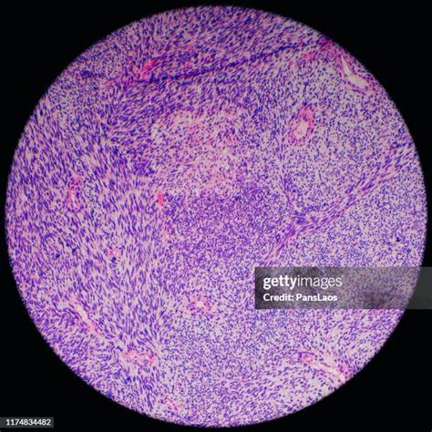 Virus Under The Microscope Photos And Premium High Res Pictures Getty Images