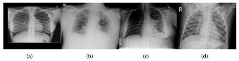 applied sciences free full text advanced medical image segmentation