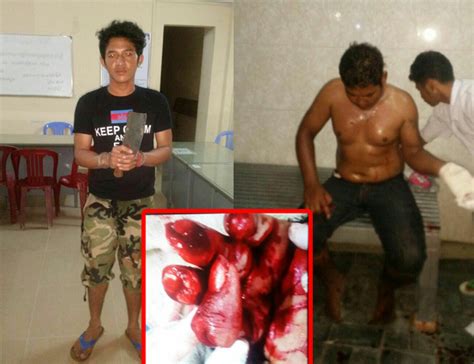 ស្រវឹងស្រាទៅ រករឿងគេដល់ផ្ទះ ត្រូវគេកាប់ដាច់ម្រាមដៃអស់៤ Look At Me 168